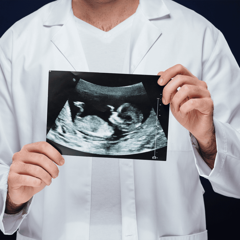 Concept Diagnostics: Best 3D/4D USG Service in Ahmedabad